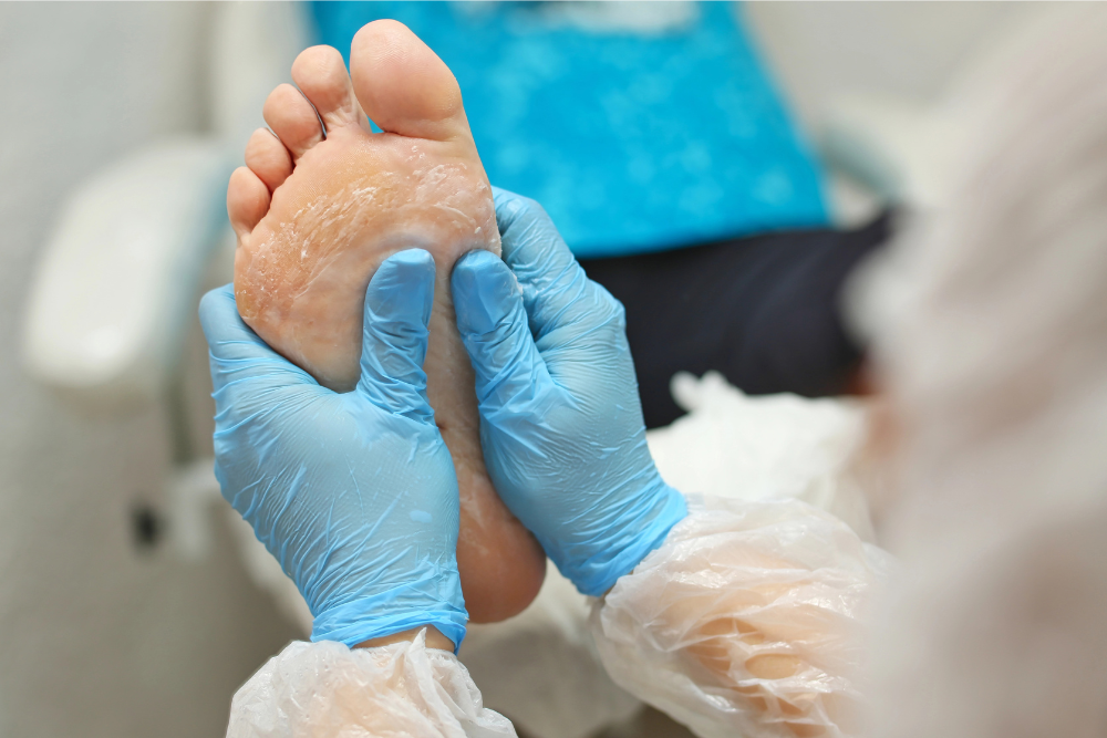 Tingling and Numb Feet: Key Strategies for Relief - LA Foot Laser
